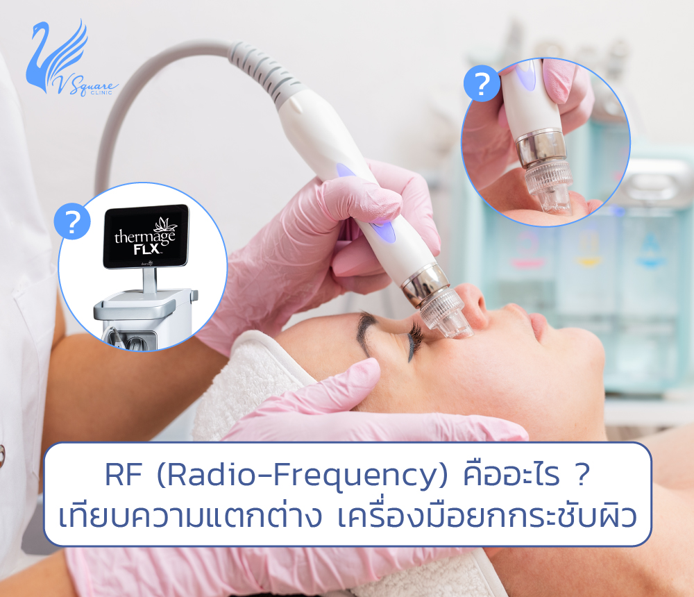 RF (Radio-Frequency) คืออะไร ? ยกกระชับผิวด้วย RF เหมาะกับใคร