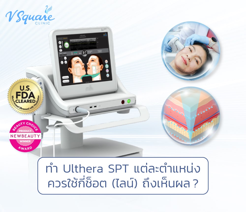 Ulthera ทำกี่ช็อต ? แต่ละตำแหน่งใช้เท่าไหร่ ? ยิ่งใช้เยอะดีจริงไหม