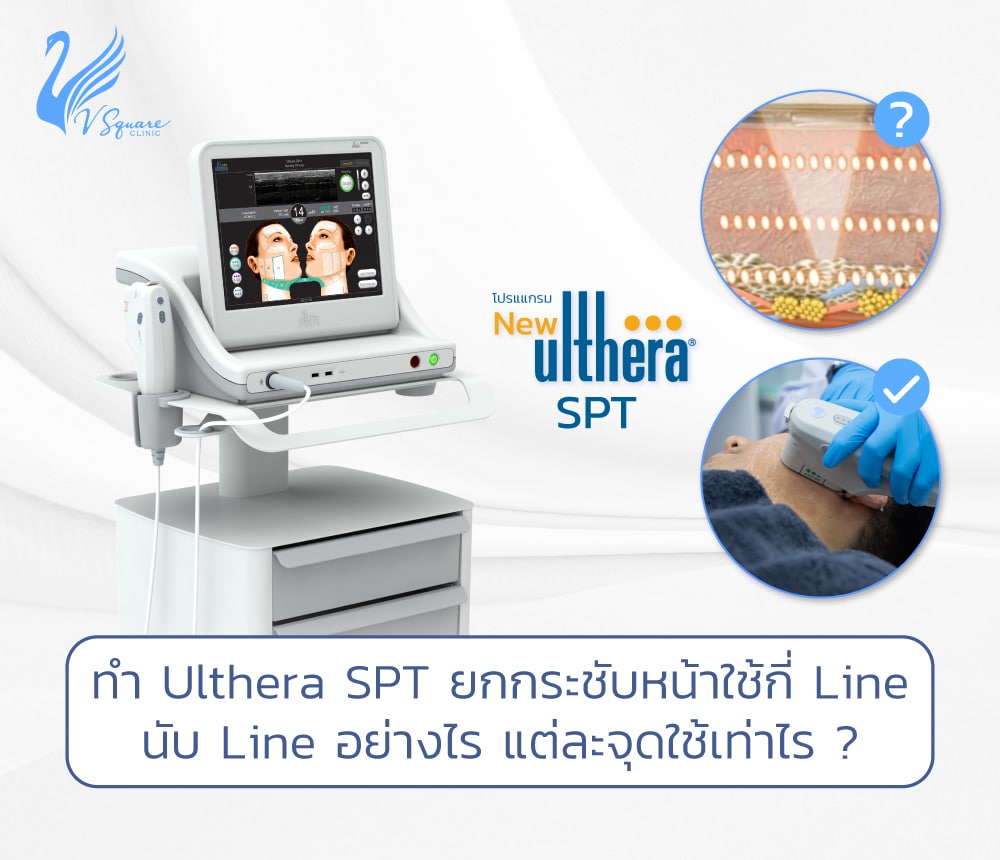 Ulthera ทํากี่ช็อต แต่ละจุดต่างกันไหม อัลเทอร่าบุฟเฟ่ต์ไม่จำกัดช็อตคือ ...