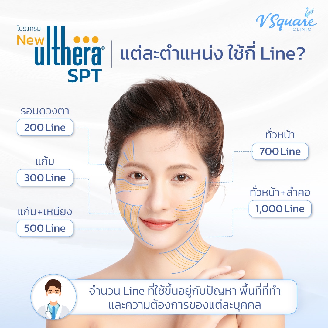 Ulthera ทำกี่ช็อต ? แต่ละตำแหน่งใช้เท่าไหร่ ? ยิ่งใช้เยอะดีจริงไหม