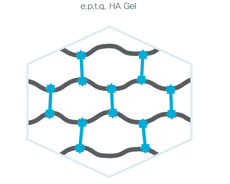 e.p.t.q. filler ฟิลเลอร์เกาหลี มีกี่รุ่น ? ต่างกับฟิลเลอร์ยี่ห้ออื่น ...