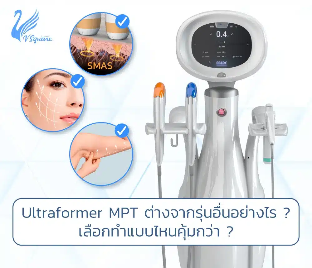 Ultraformer MPT ต่างจากรุ่นอื่นอย่างไร เทียบความคุ้มค่า เลือกแบบไหนดี