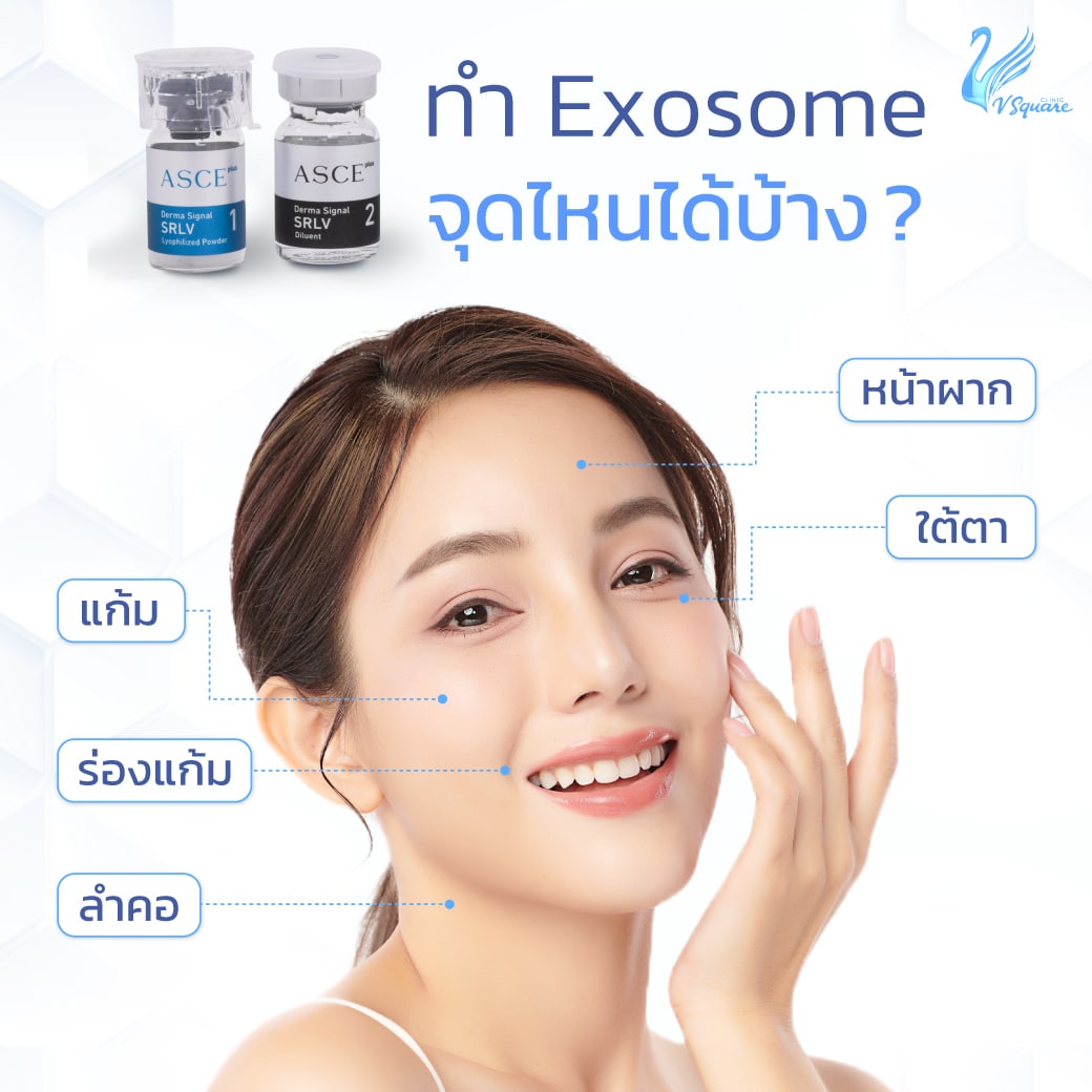 exosome คืออะไร ? ราคาเท่าไหร่ ตัวเลือกที่ดีที่สุด จริงไหม