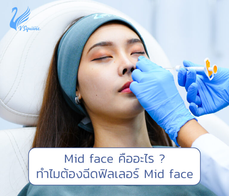 mid face คืออะไร ต้องฉีดจุดไหน ปรับรูปหน้าให้มีมิติ ดูอ่อนเยาว์