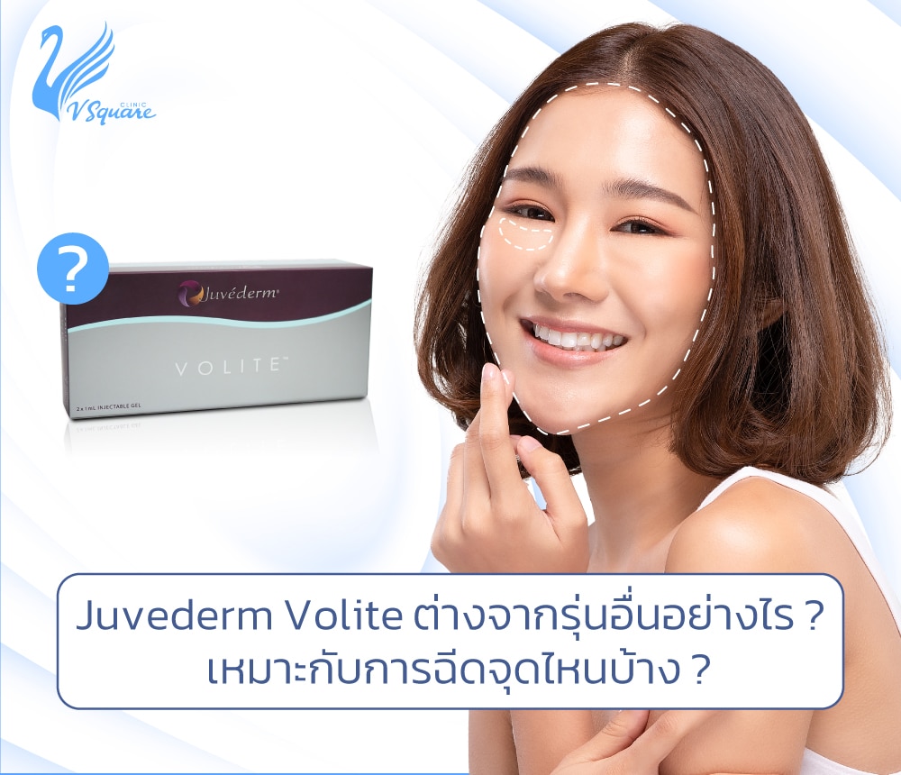 juvederm volite ช่วยเรื่องอะไร ? ราคาเท่าไหร่ มีจุดเด่นอะไรบ้าง