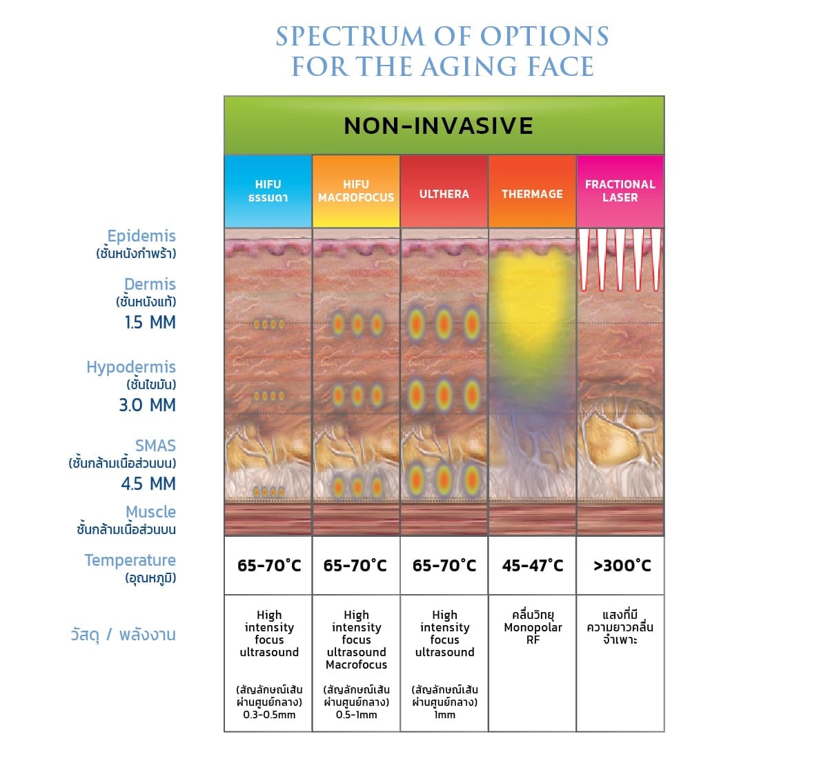 Ulthera vs Hifu ยี่ห้อต่างๆ กับ Thermage เลือกทำอะไรดีที่สุด