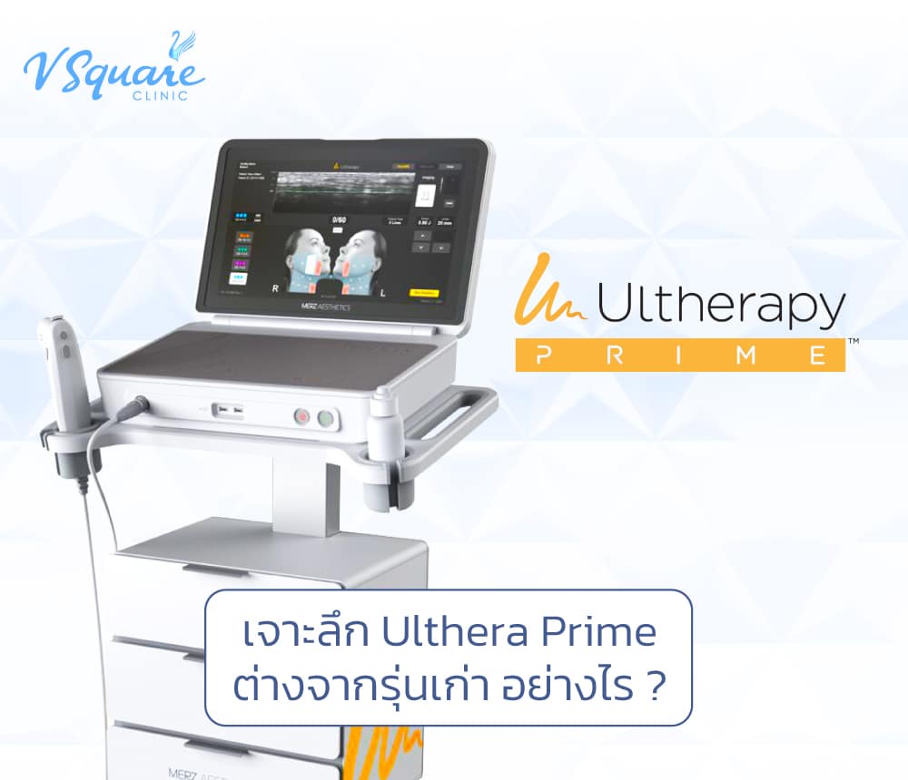 ulthera prime การยกกระชับที่อัปเกรดยิ่งขึ้น เห็นผลไว เจ็บน้อยลง