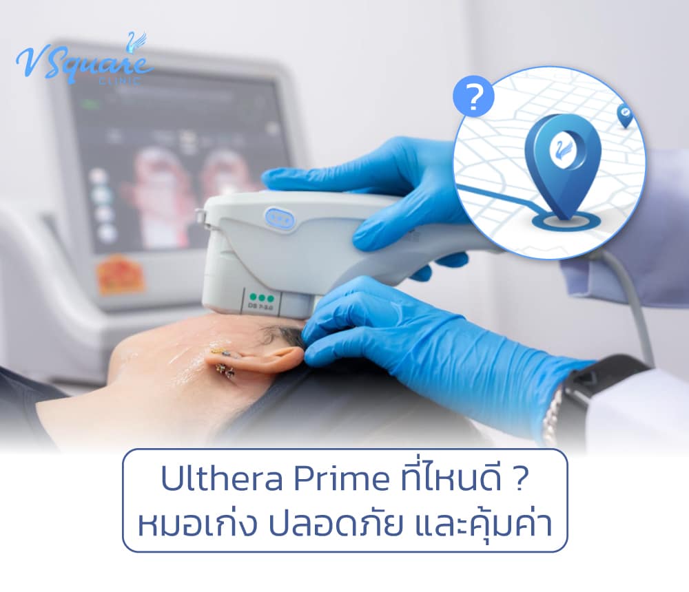 Ulthera Prime ที่ไหนดี ? พิกัด 31 คลินิกตัวท็อป อัปเดต 2025