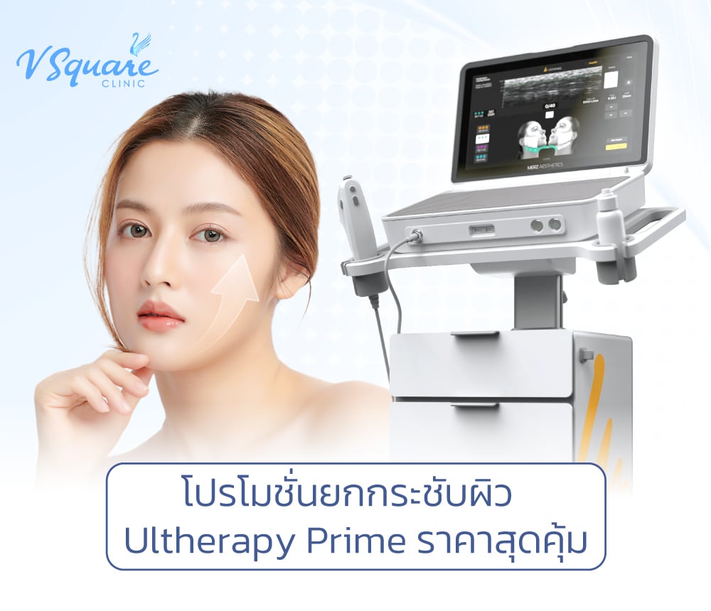 Ultherapy Prime ราคาเท่าไหร่ ? โปรโมชันยกกระชับคุ้มราคา 2025