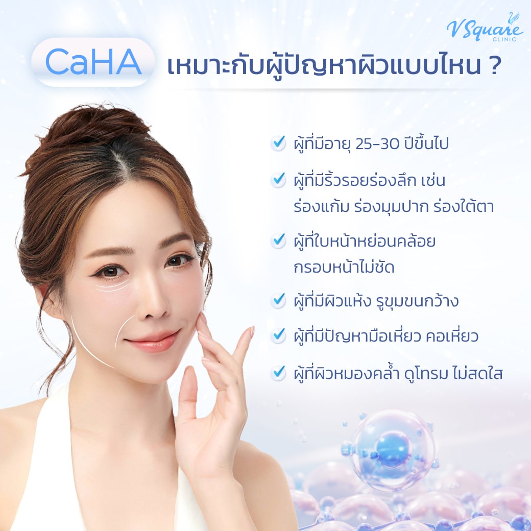 CaHA คืออะไร ? ช่วยกระตุ้นคอลลาเจน ฟื้นฟูผิวได้อย่างไร