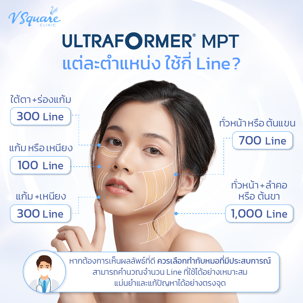 Ultraformer MPT ราคาพิเศษ อัปเดตโปรโมชัน 2025 ยกหน้า ลดไขมัน