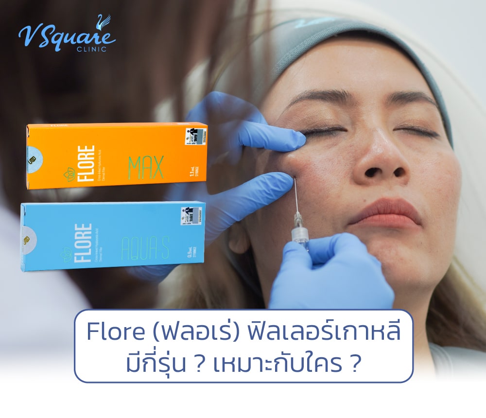 ฟิลเลอร์ Flore (เกาหลี) จุดเด่น เทคโนโลยี ข้อดี และข้อเสีย