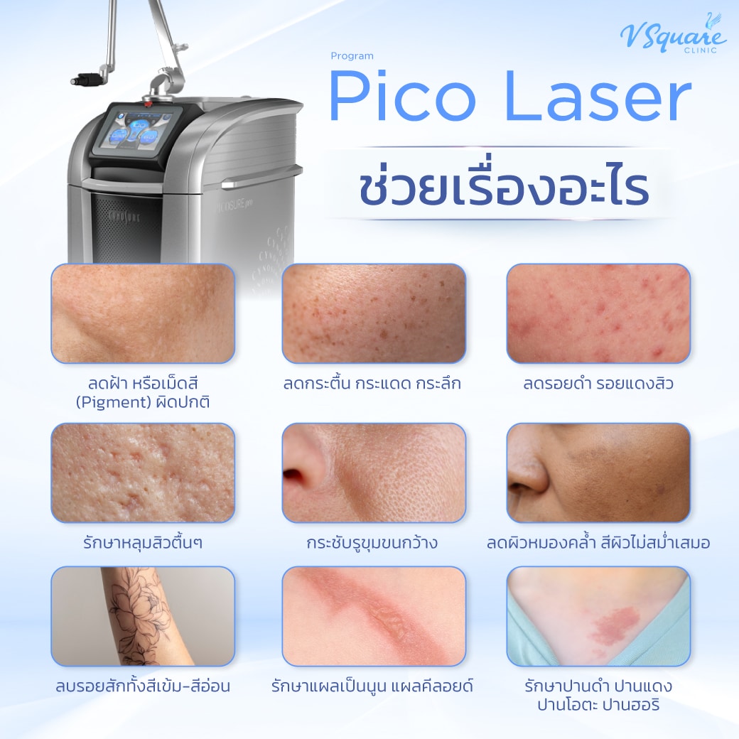 Pico Laser คืออะไร ดีไหม มีกี่แบบ เหมาะกับใคร เจ็บไหม