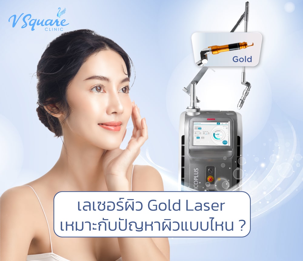 Gold Laser เลเซอร์รอยแดง ฝ้าเลือด ผิวใสแบบไม่ต้องพักฟื้น