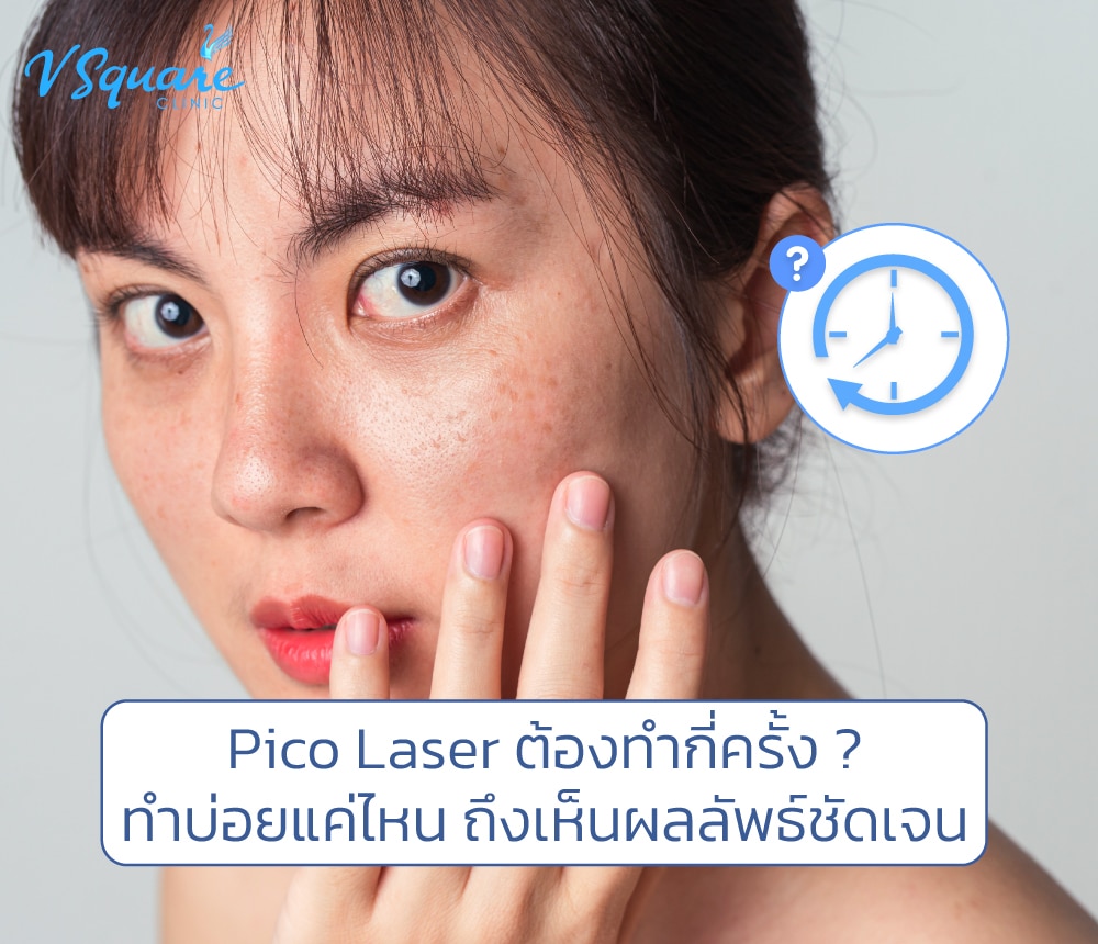 Pico Laser ต้องทํากี่ครั้ง ? ทำบ่อยแค่ไหน ถึงจะเห็นผลชัดเจน