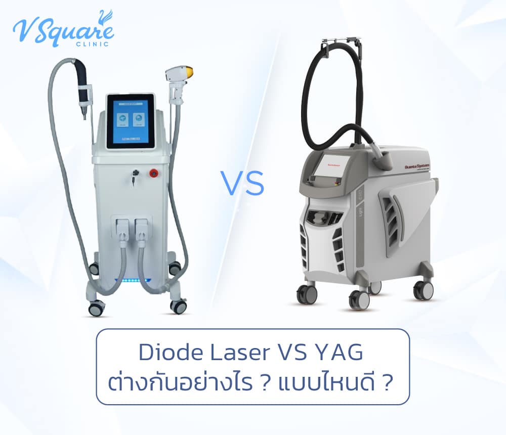 Diode Laser VS YAG เจาะลึกความต่าง เลือกให้เหมาะกับคุณ