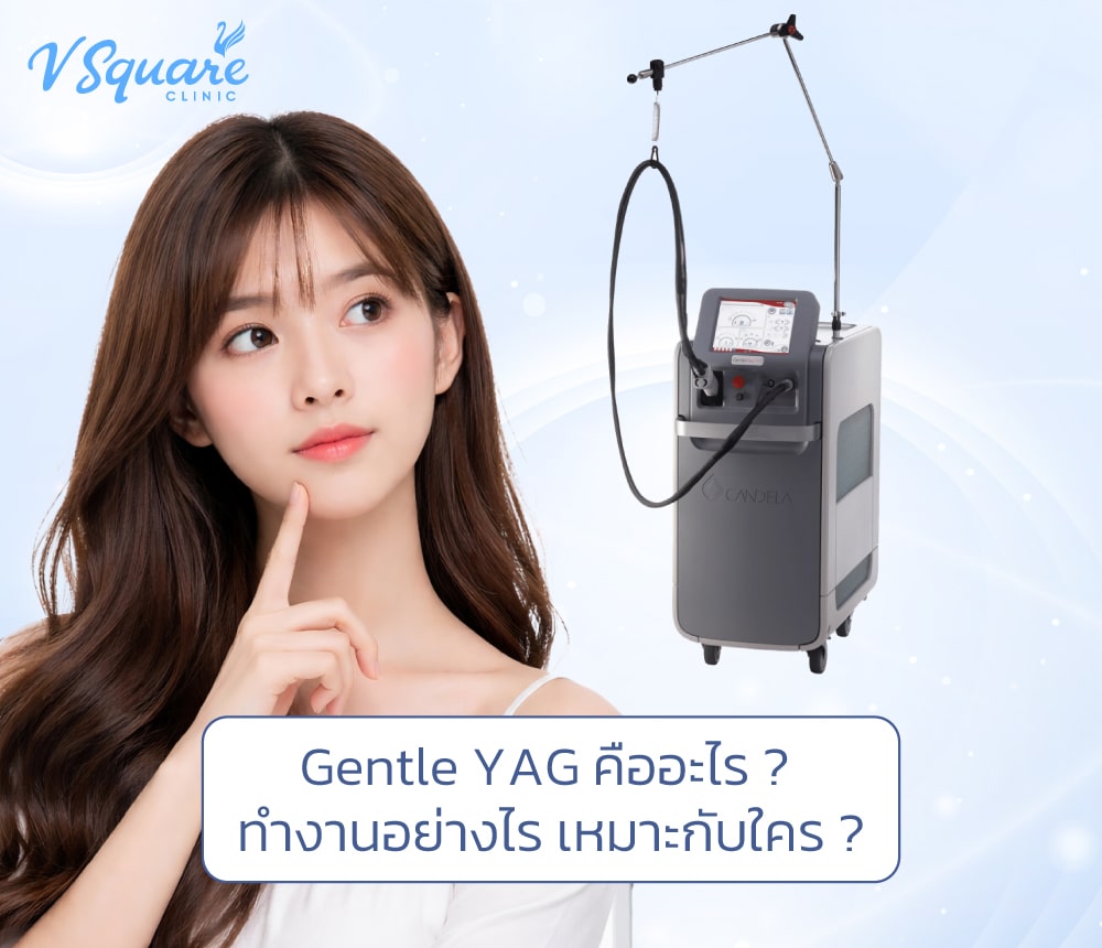 Gentle YAG เลเซอร์กำจัดขน 1064 nm เจาะลึกกลไก