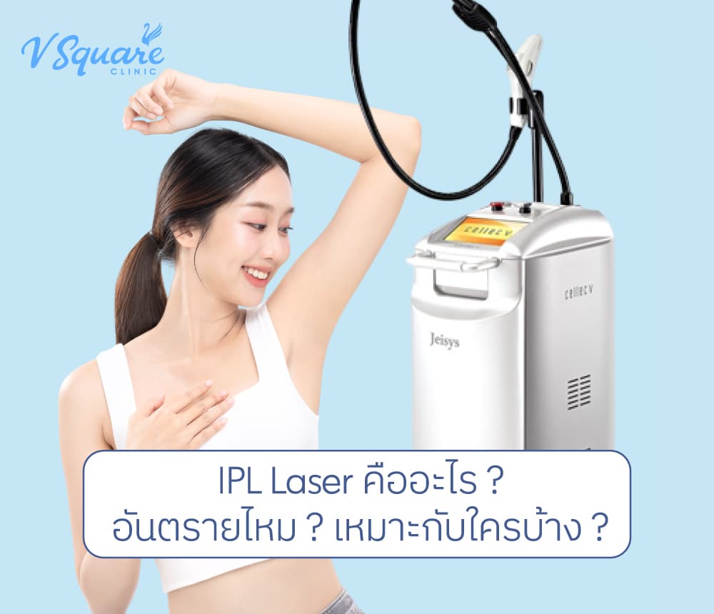 IPL Laser กำจัดขนได้จริงไหม ? ต่างจากเลเซอร์อื่นอย่างไร