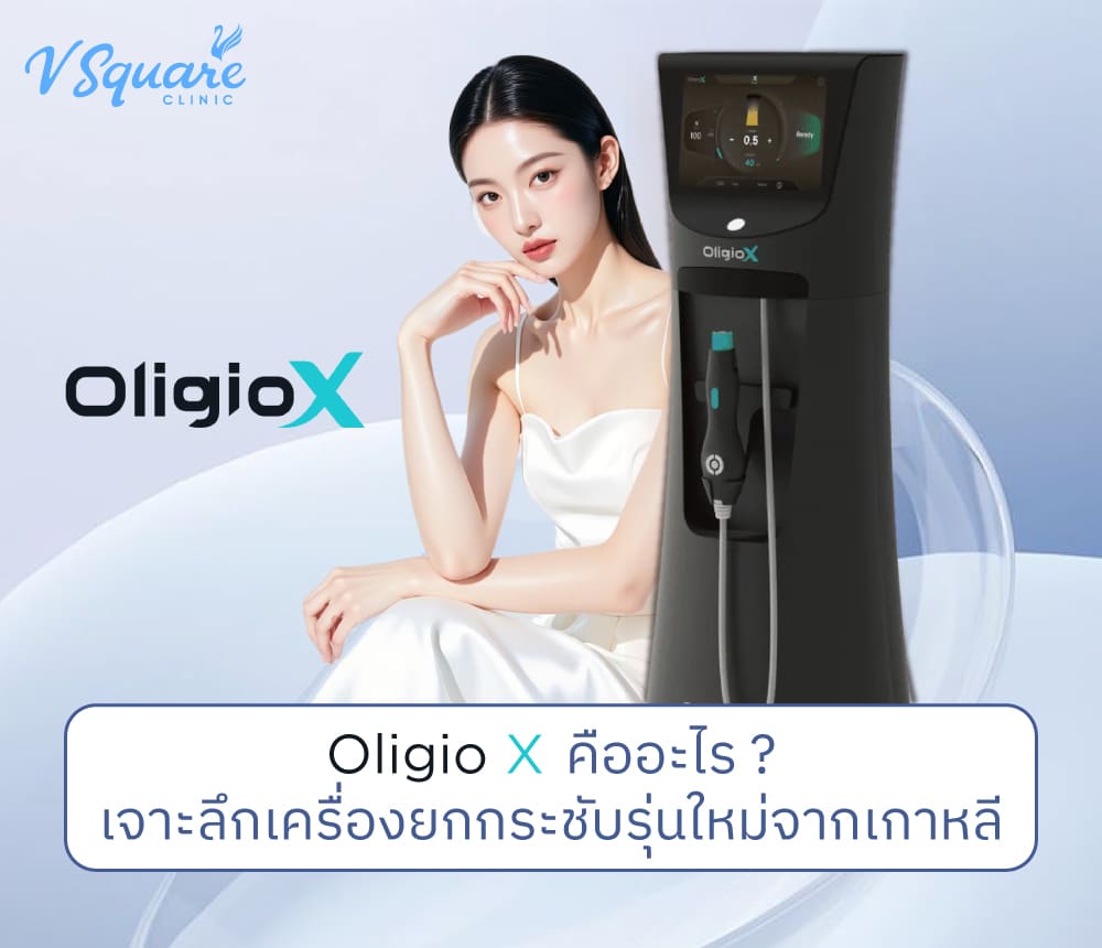 Oligio X ต่างจากรุ่นเดิมอย่างไร ? รวมข้อควรรู้ก่อนตัดสินใจทำ
