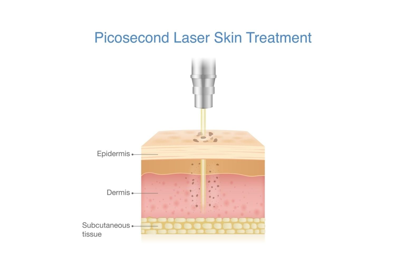 Pico Laser: What It Is, Who It's For, and How It Works