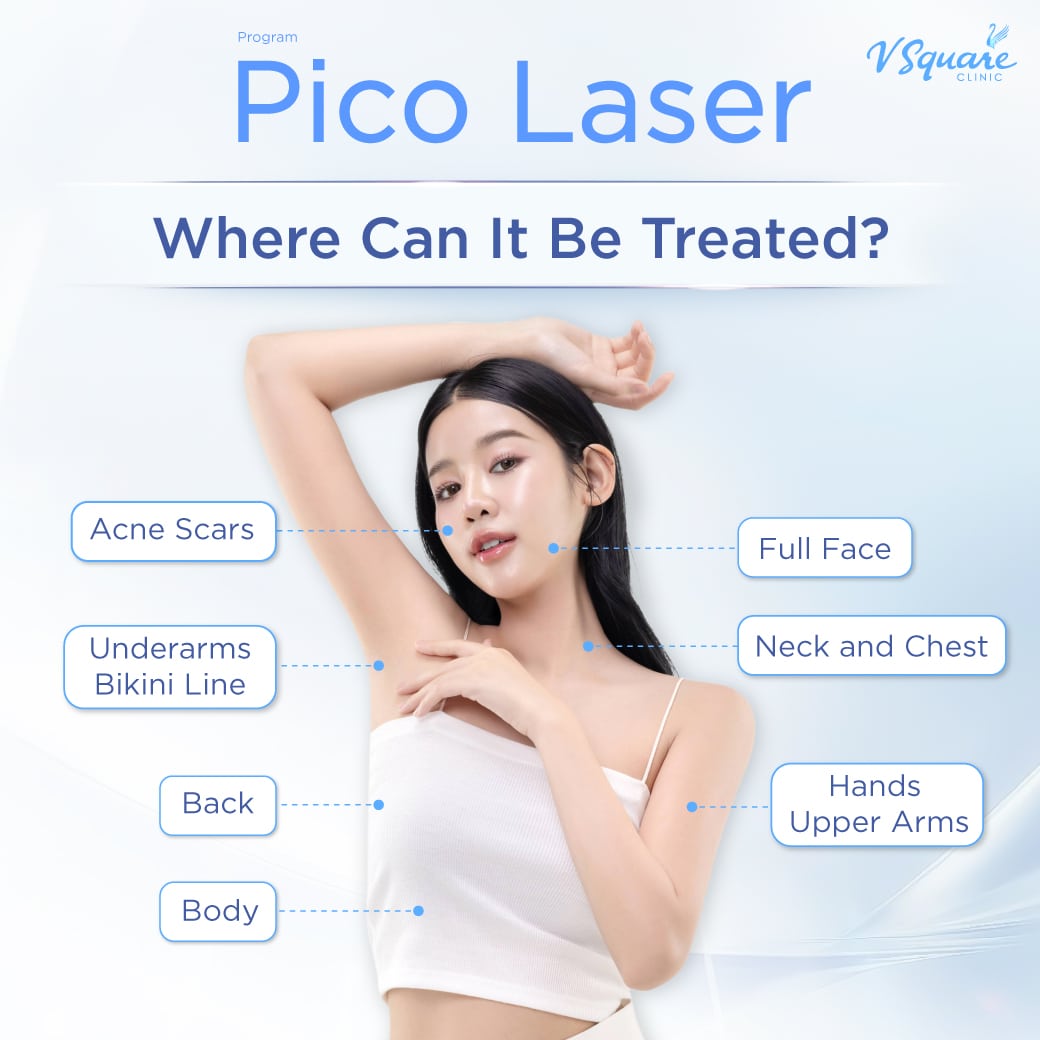 Pico Laser: What It Is, Who It's For, and How It Works