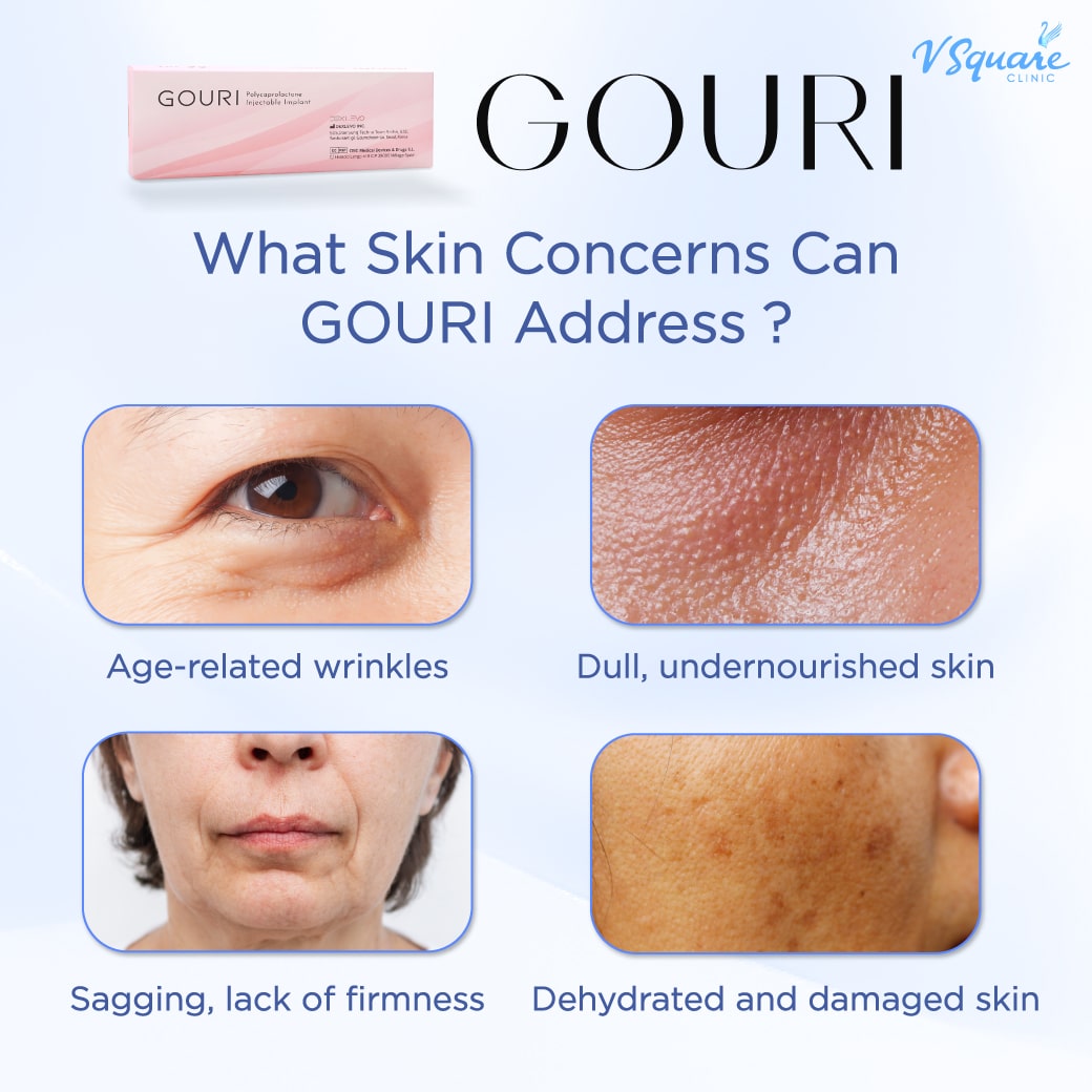 Gouri: What Is It and How Much Does It Cost? 2026 Skin Trend