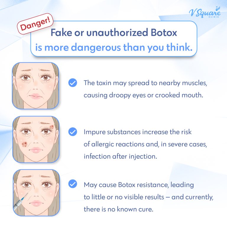 Botox Injections: What They Are, Benefits & How Long They Last