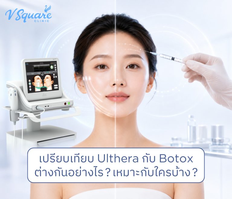 Ulthera กับ Botox ต่างกันอย่างไร? ทำพร้อมกันได้ไหม? มีคำตอบ!